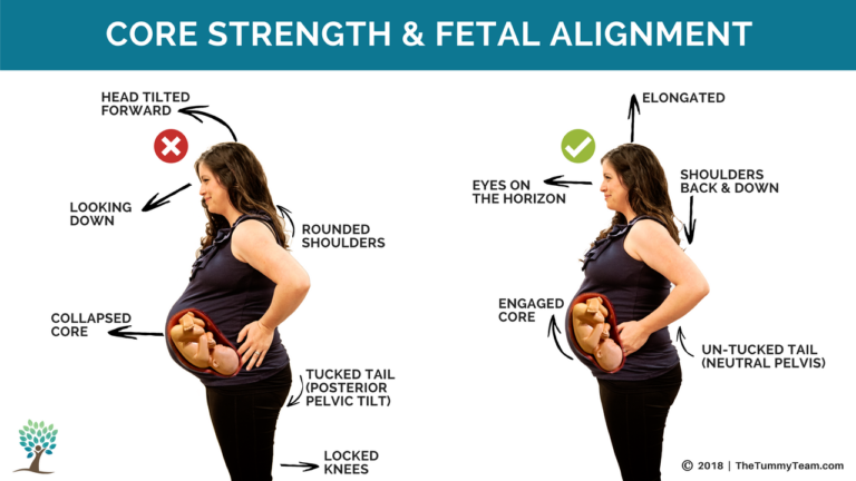 Posture Throughout Pregnancy is Important